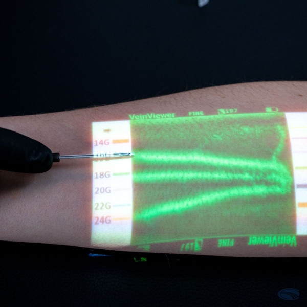 VeinViewer Flex Imaging System | CAREstream America